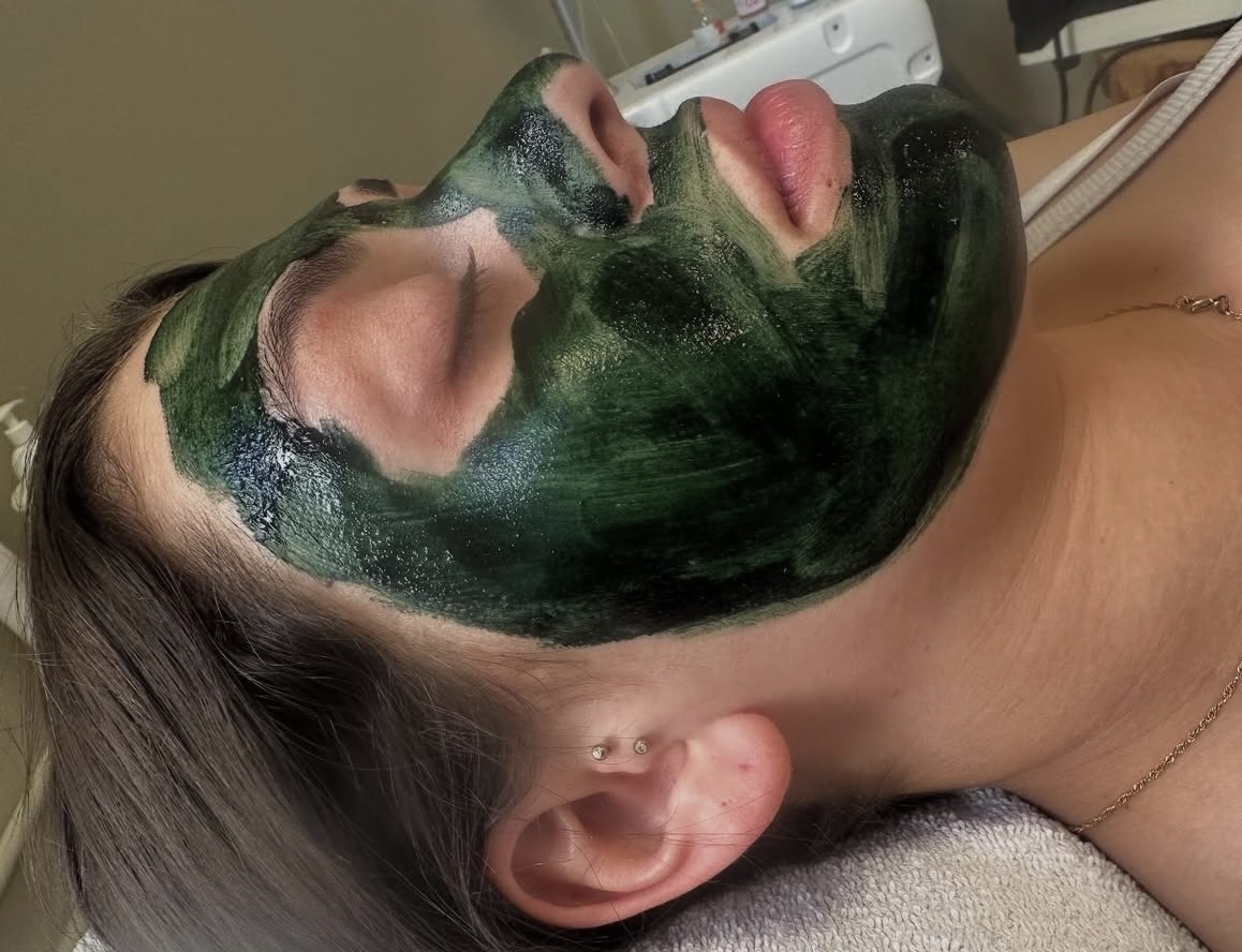 Kursus i Green Peel 🌿 - Klinik Body & Face